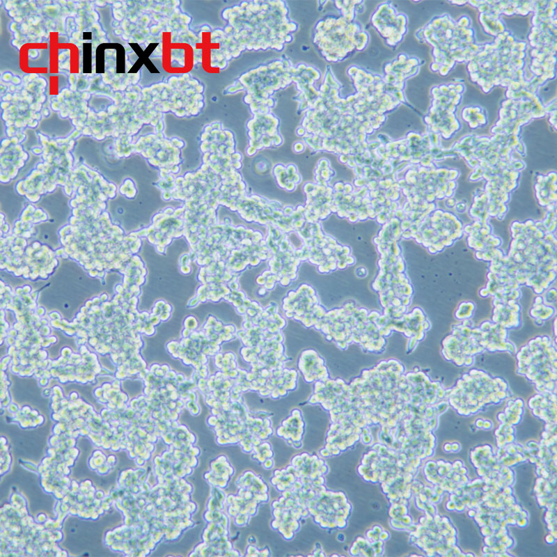 VCAP 人前列腺癌细胞(STR鉴定)_南京中欣博泰生物技术有限公司